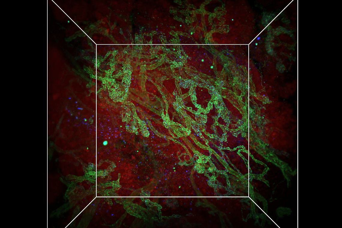 INBS – The Chan Lab
