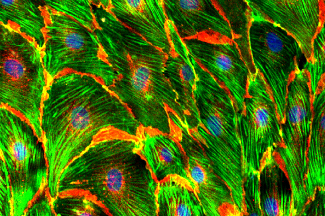 INBS – The Chan Lab